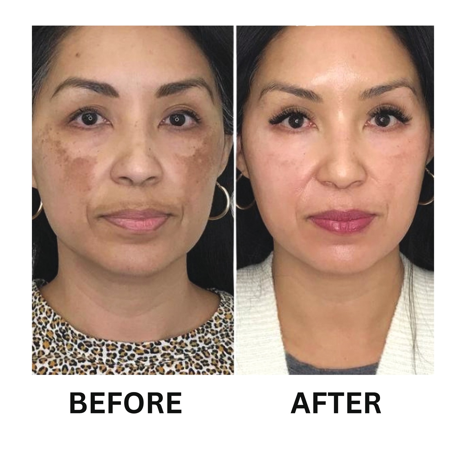 Skin Whitener Bleaching Cream | Dr. Leonard's