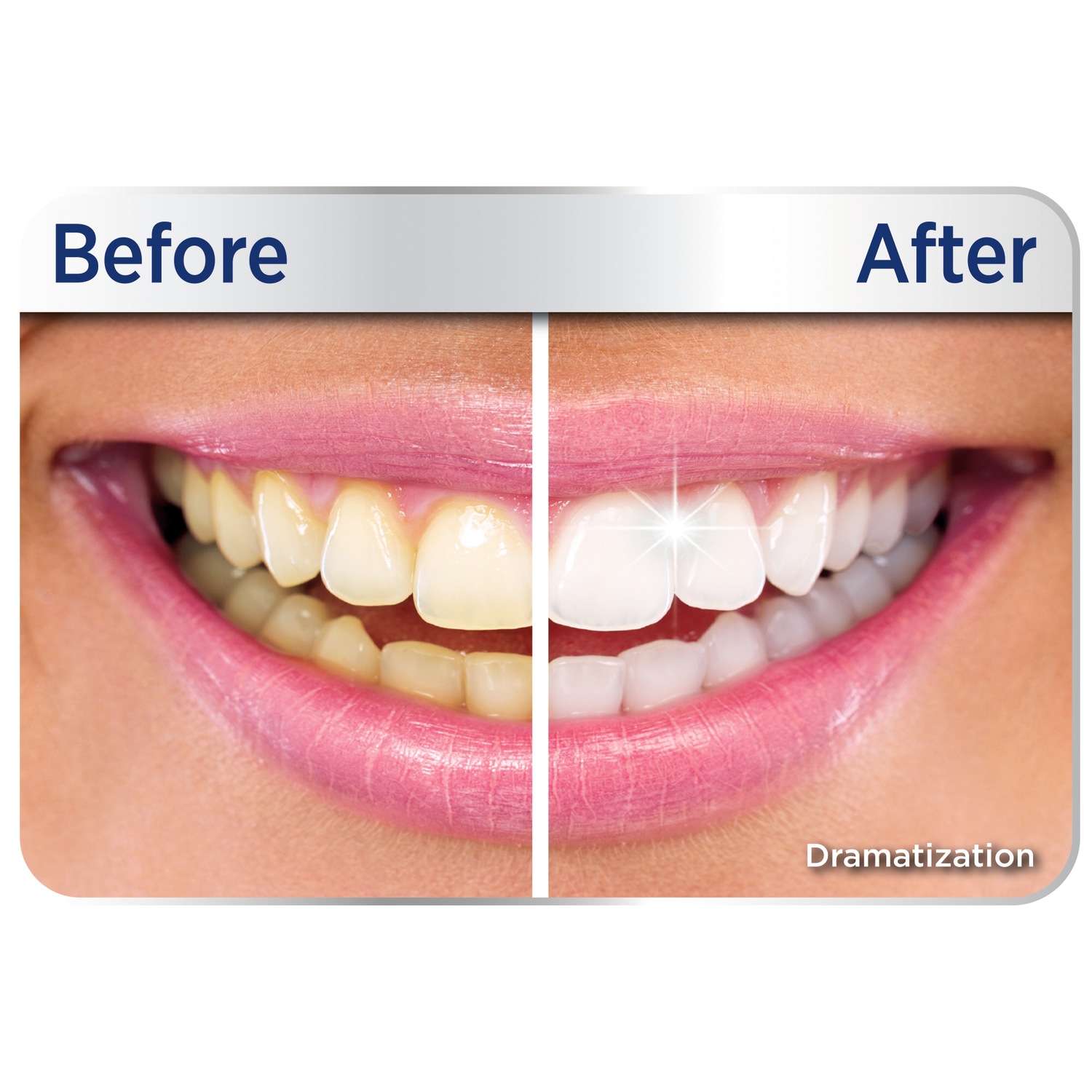 Miracle Smile Teeth Whitening Gel | Dr. Leonard's