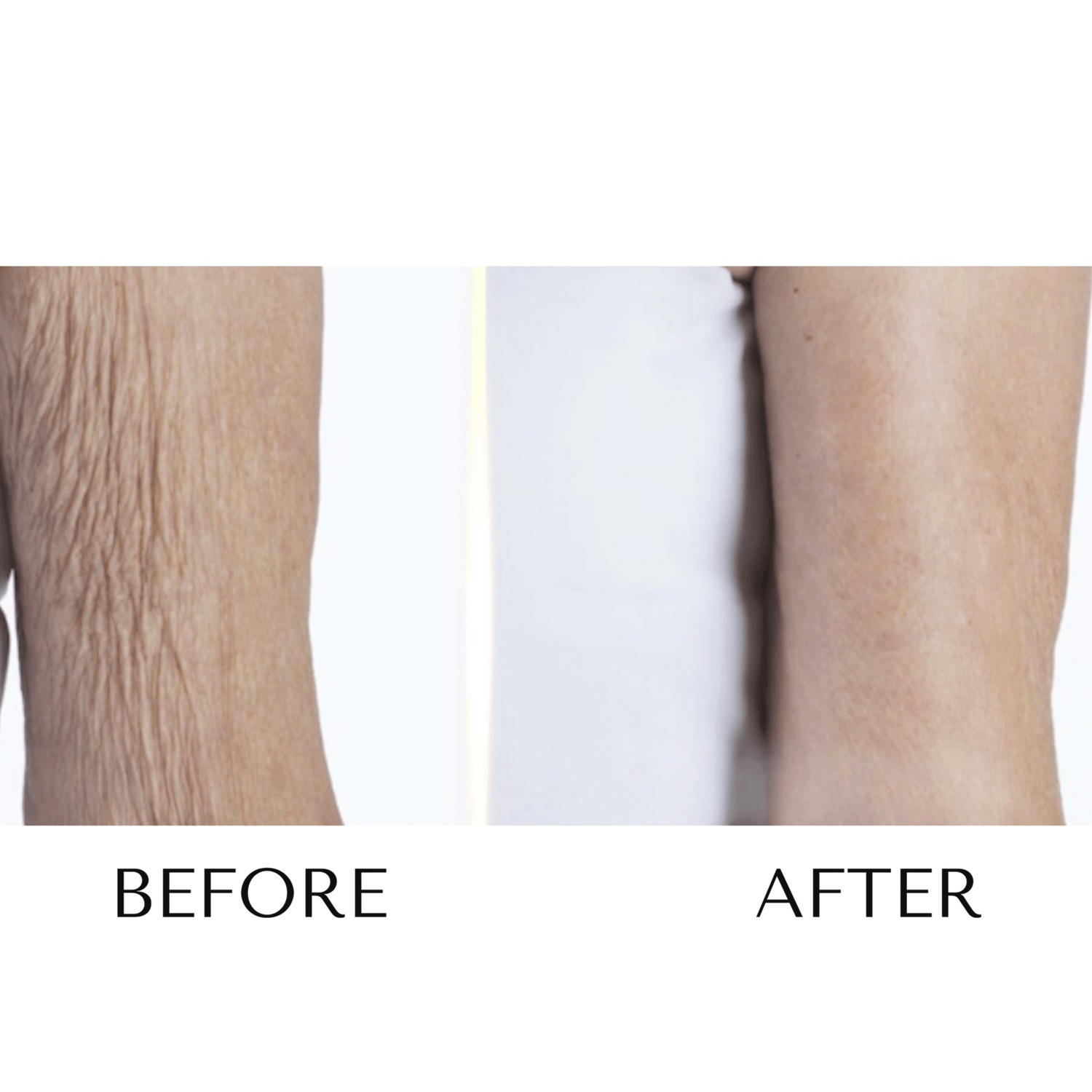 Crepe Skin Miracle Upper Arm Firming Cream | Dr. Leonard's